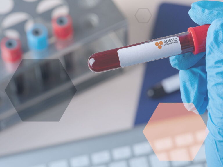 Todo lo que necesitas saber sobre la amilasa en suero: ¿Qué es y cómo afecta tu salud?