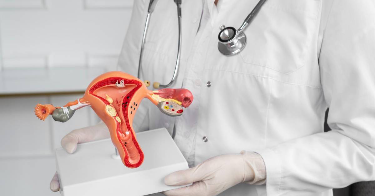 Todo lo que debes saber sobre la extirpación de un ovario: efectos ...