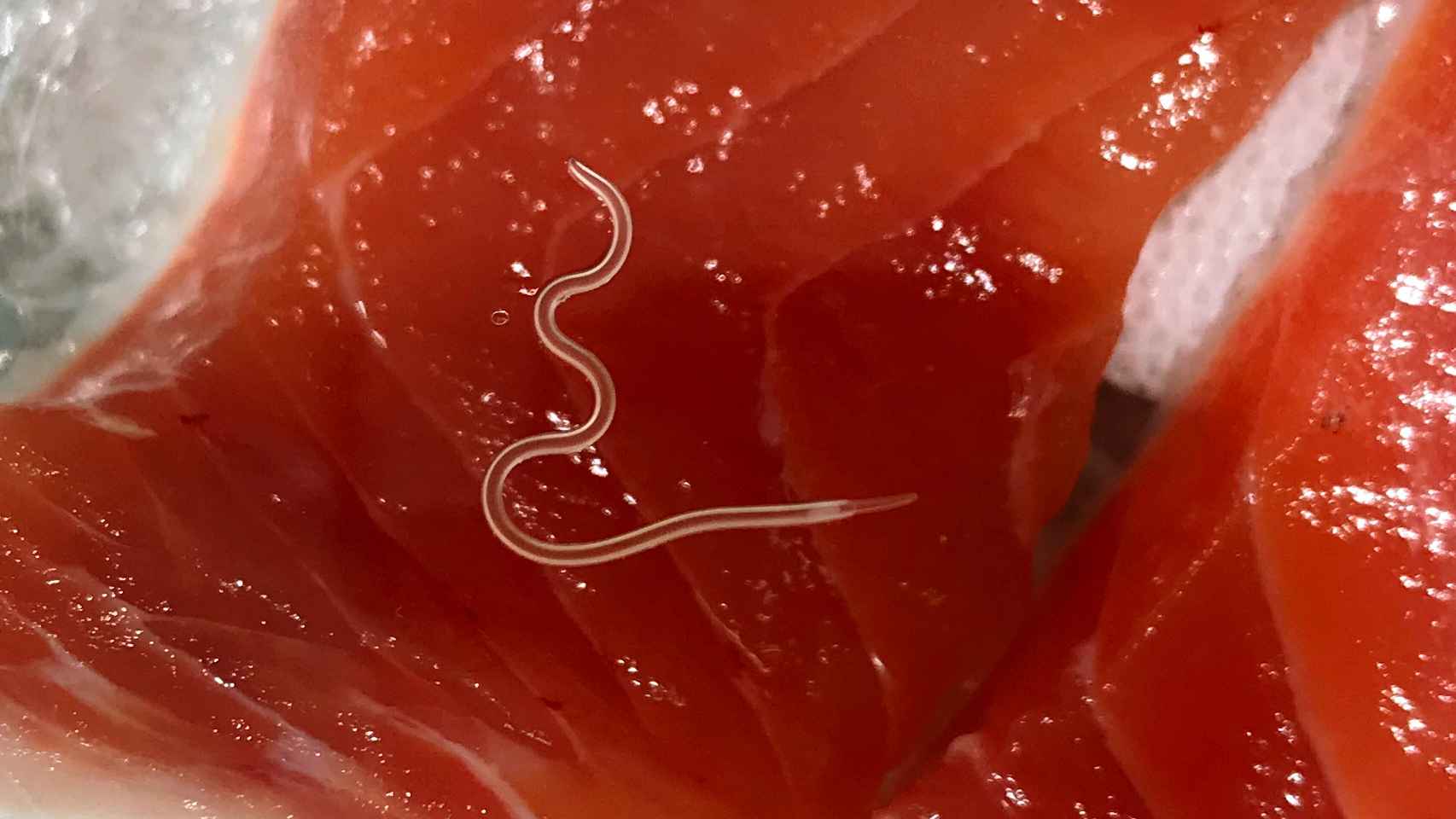 ¡Descubre cómo eliminar el Anisakis de tu cuerpo y protege tu salud de ...